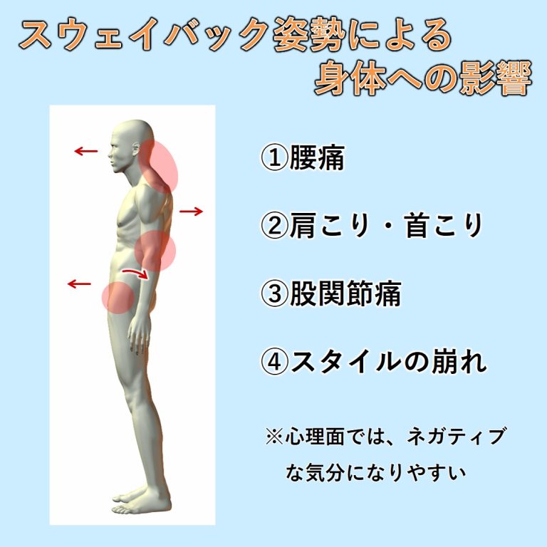 スウェイバック姿勢｜腰痛｜スウェイバック姿勢による身体への影響 フィジカルコンディショニングセンター成増